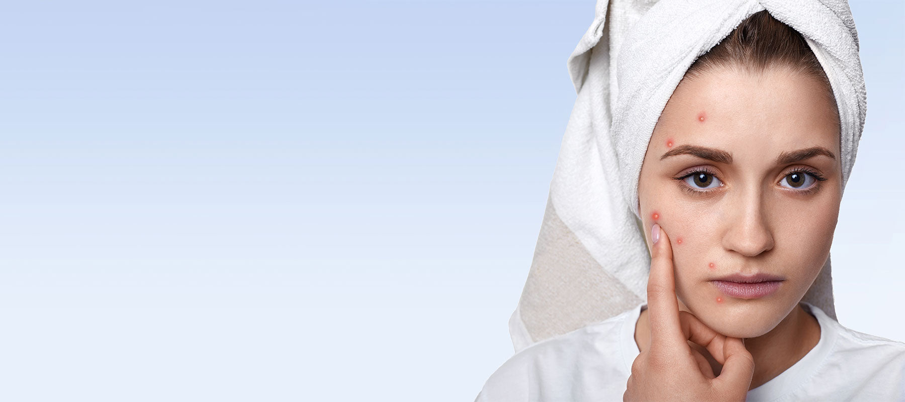 Ingredients That Help Fight Acne Breakouts Naturally